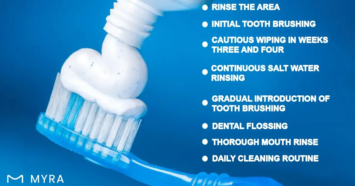 Custom-Made Abutment: Description, Role, Procedure, Average Cost, and ...