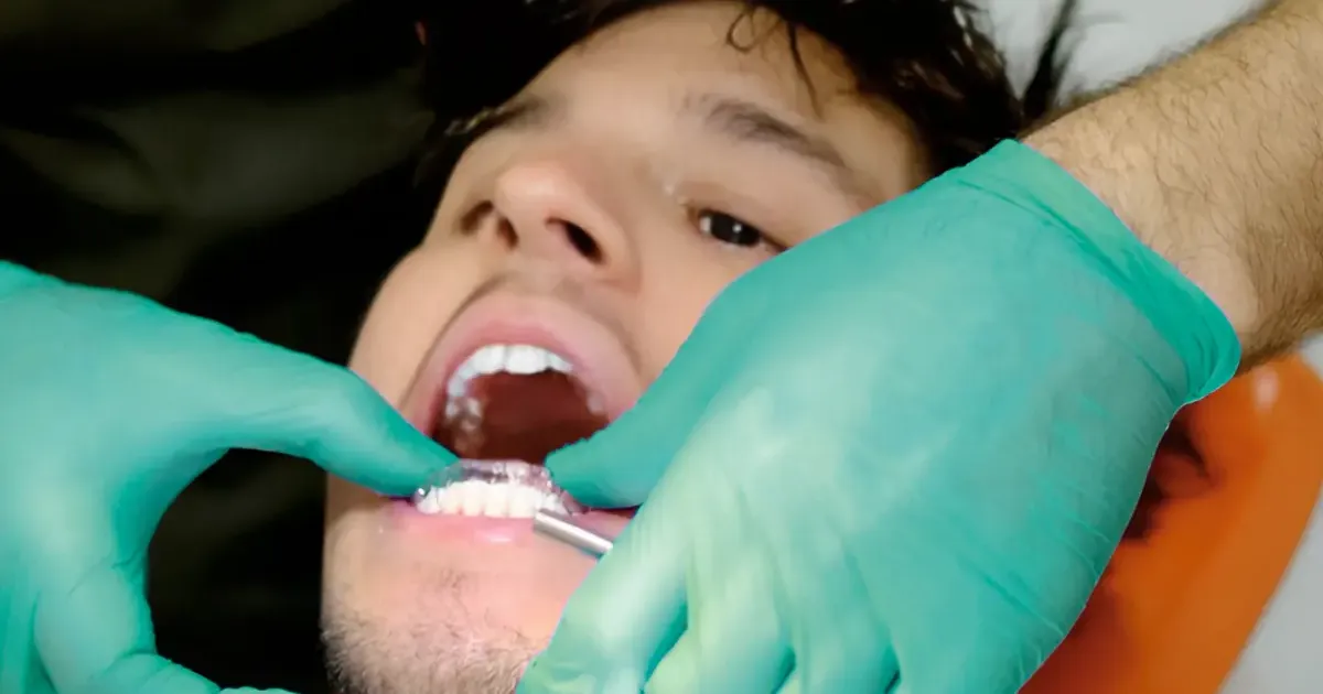 Gum Shield: Definition, Importance, Purpose, and How it Works?